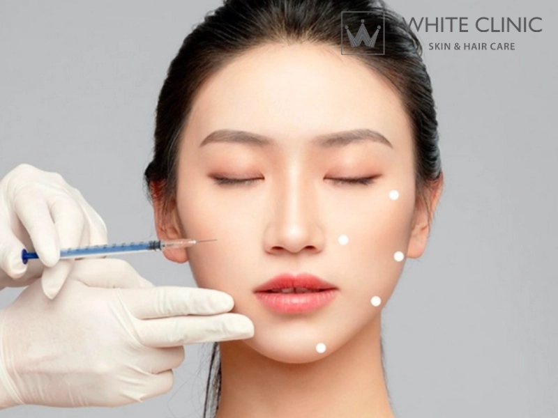 BIO LIFT 20 Giải Pháp Kích Thích Sinh Học Tái Tạo Da, Làm Đầy Sẹo & Trẻ ...